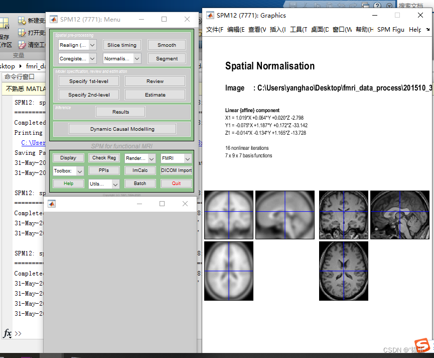 SPM处理fMRI数据的基本步骤_spm 二阶分析-CSDN博客