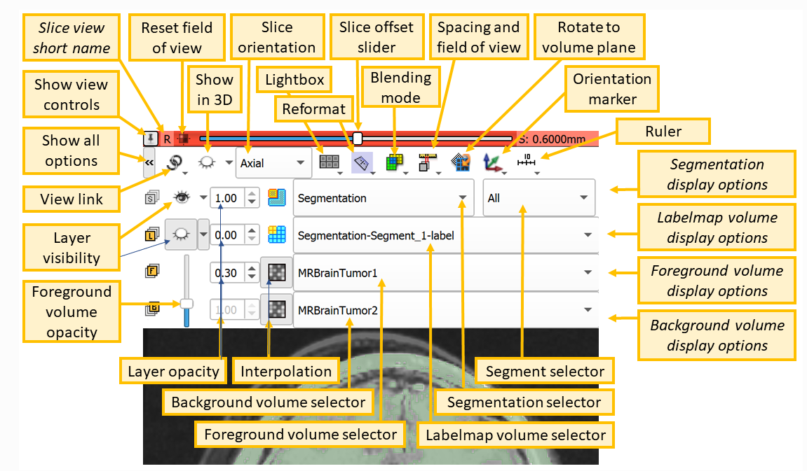 slicer学习笔记（二）界面与视图工具_slicer 4维数据显示-CSDN博客
