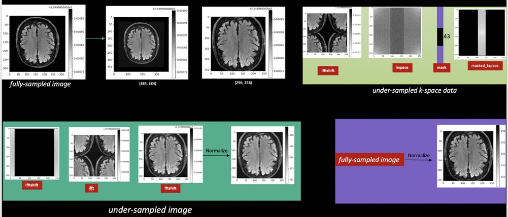 pg_mri----brain reconstruction_kspace 转换到image-CSDN博客
