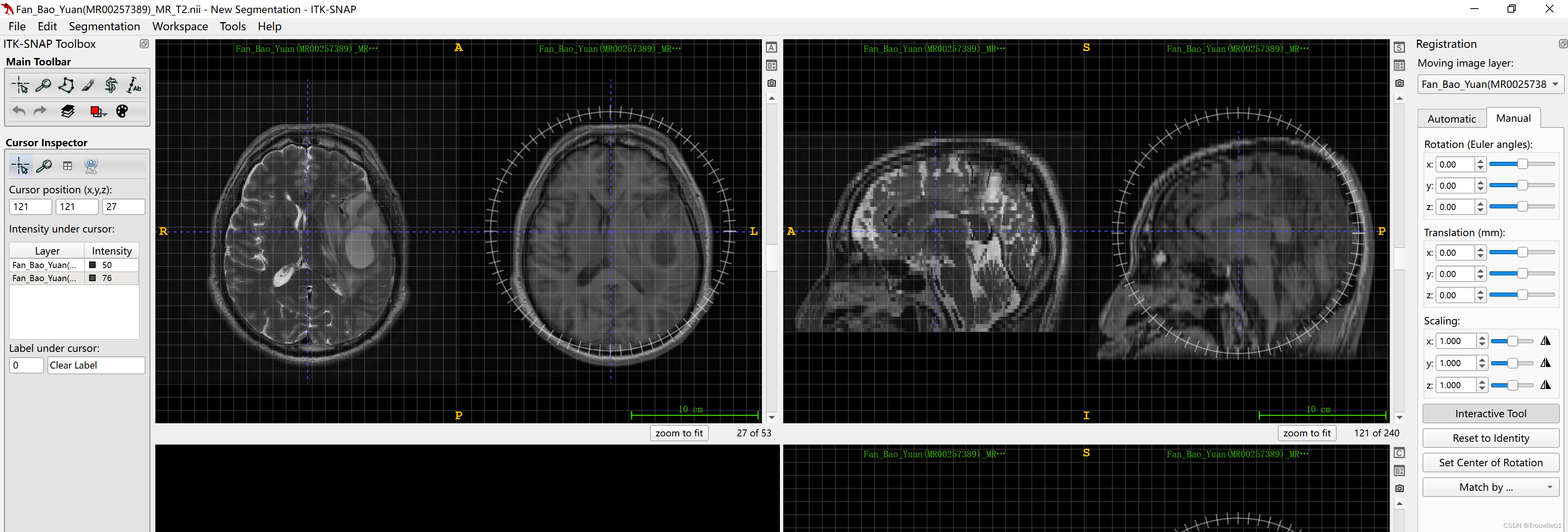 介绍一种医学影像配准的方法（使用itk-snap)_itksnap使用教程-CSDN博客