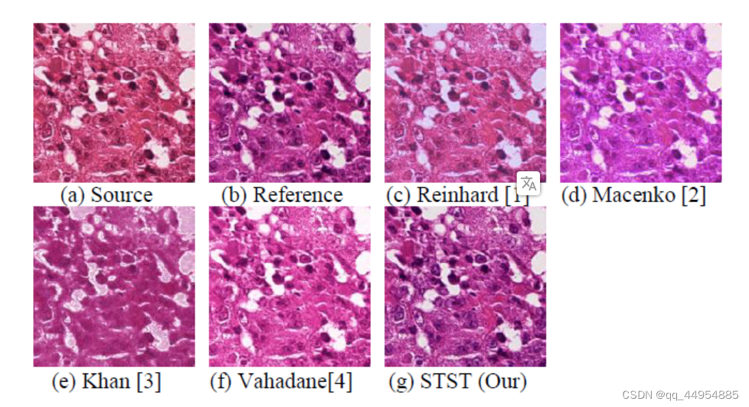 【李佳辉_周报_2022.10.2】_pix2pix-based stain-to-stain translation-CSDN博客