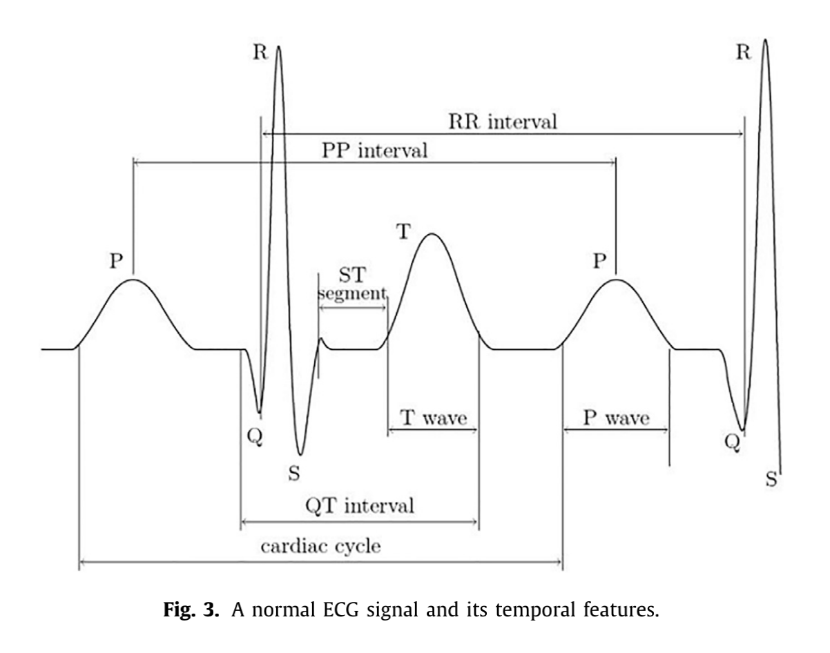 ECG classification using three-level fusion of different feature descriptors 论文_handcrafted ...