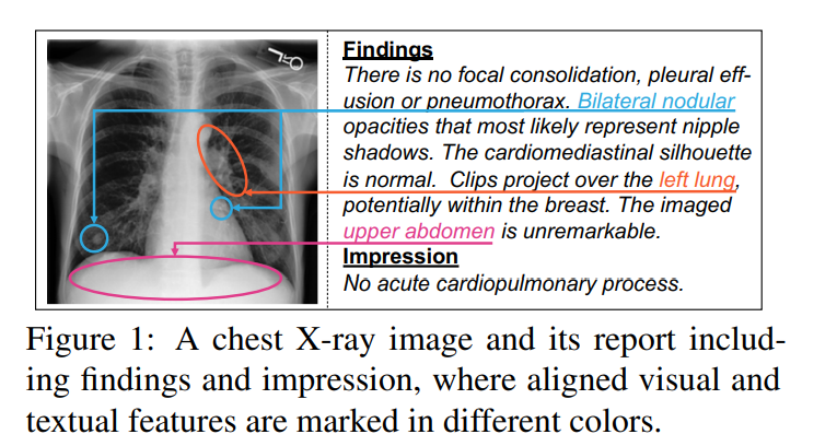 Cross-modal Memory Networks for Radiology Report Generation翻译-CSDN博客