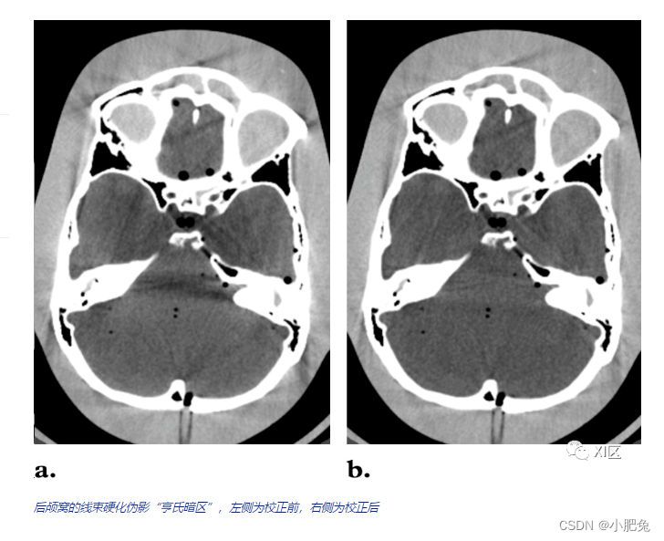 CT伪影：根本原因与规避方法_小鼠ct运动伪影-CSDN博客