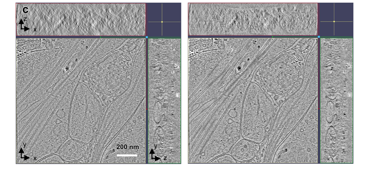 【论文阅读|cryoET】Isotropic reconstruction for electrontomography with deep ...