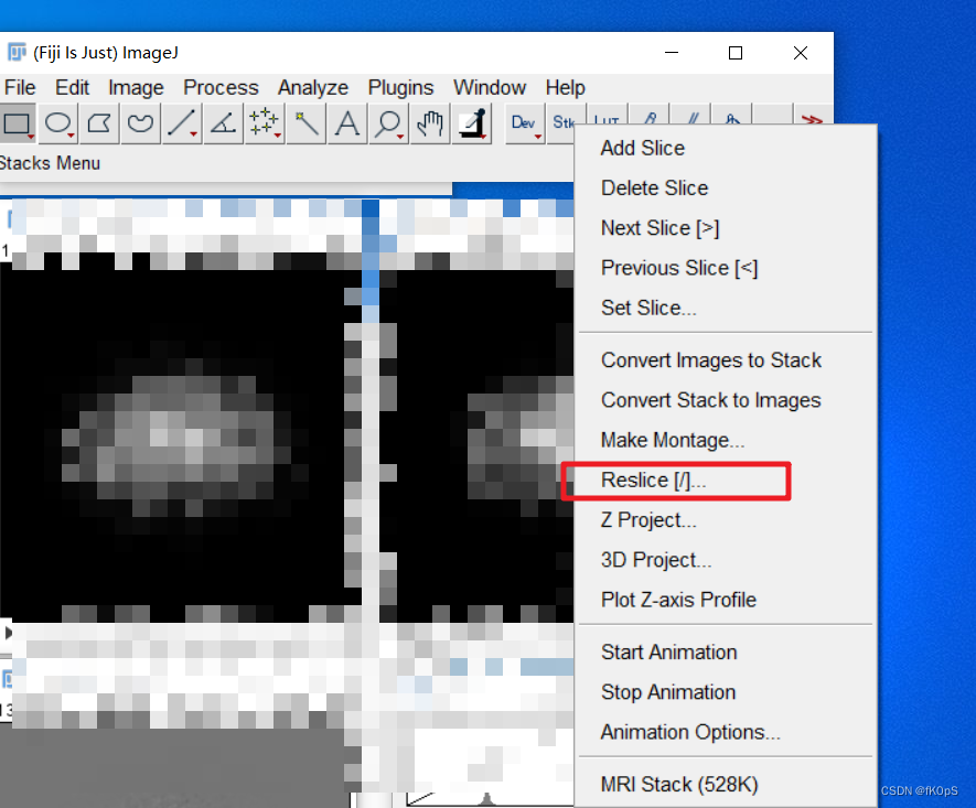 如何使用imageJ玩医学图像 dicom_imagej打开dicom文件-CSDN博客