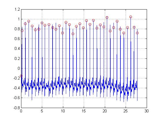 利用MATLAB读取PHYSIONET数据库的具体步骤-CSDN博客