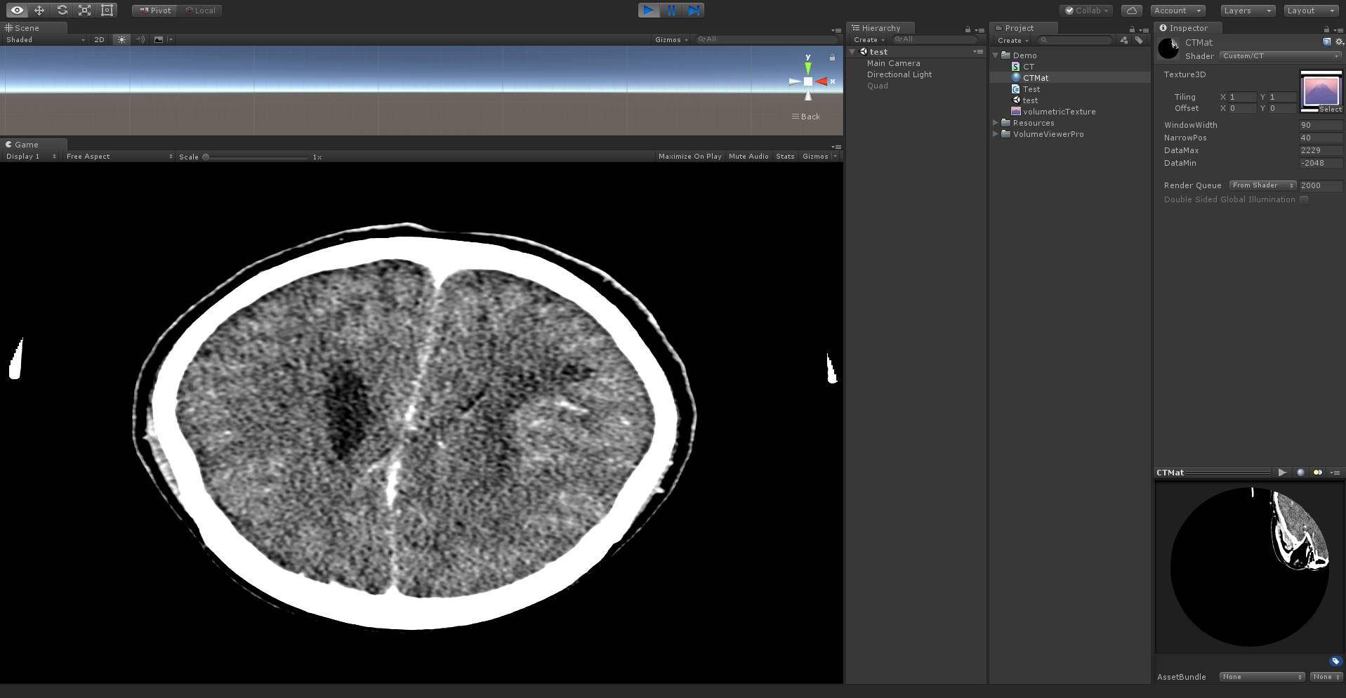 shader实现二维CT图像效果_volume shader代码 ct-CSDN博客