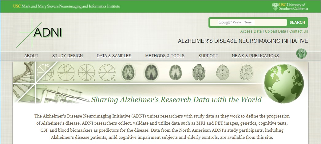 【ADNI】数据预处理（1）SPM，CAT12；数据集_spm 灰质密度提取-CSDN博客