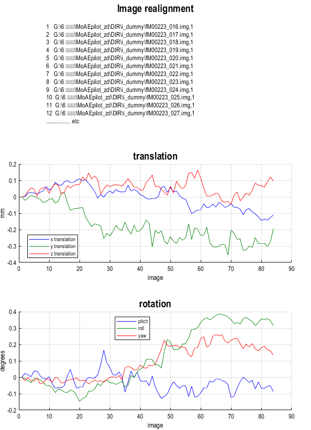 利用matlab的SPM12进行功能核磁共振成像数据处理_Auditory fMRI data（一）_matlab定量分析核磁数据-CSDN博客