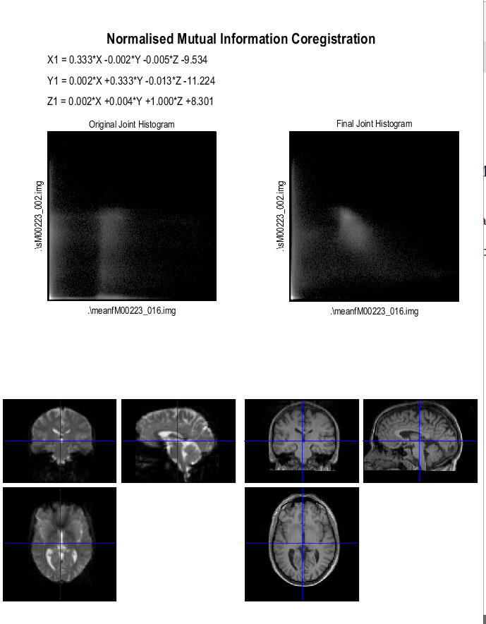 利用matlab的SPM12进行功能核磁共振成像数据处理_Auditory fMRI data（一）_matlab定量分析核磁数据-CSDN博客