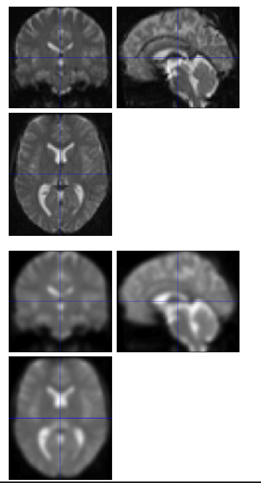 利用matlab的SPM12功能核磁共振成像数据处理_Auditory fMRI data（二）_如何用spm做功能像激活图-CSDN博客