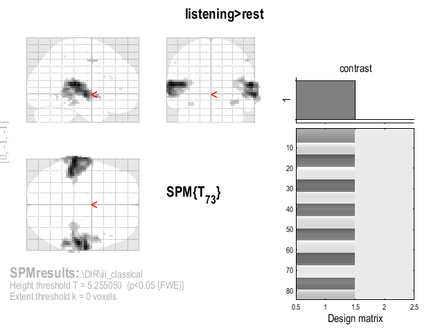 利用matlab的SPM12功能核磁共振成像数据处理_Auditory fMRI data（三）_核磁spmt-CSDN博客