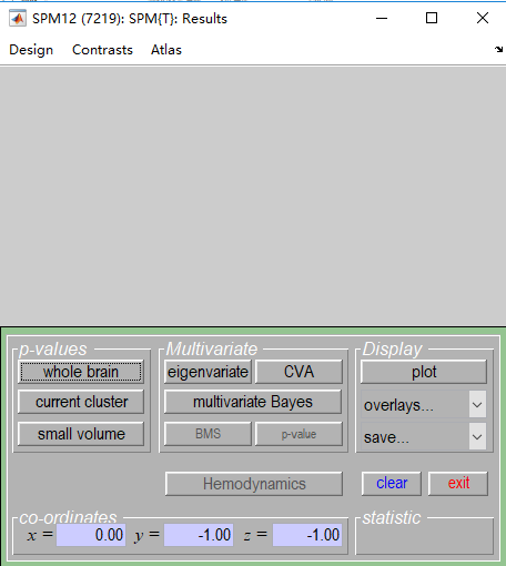 利用matlab的SPM12功能核磁共振成像数据处理_Auditory fMRI data（三）_核磁spmt-CSDN博客