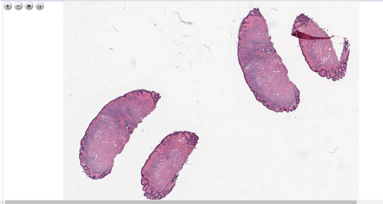 医学病理图片(SVS格式)的格式转换与显示——python实现_svs病理文件如何打开-CSDN博客