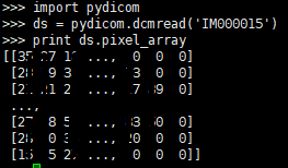 采用pydicom+gdcm读取压缩DICOM图像（如JPEG Lossless）_pydicom官网-CSDN博客