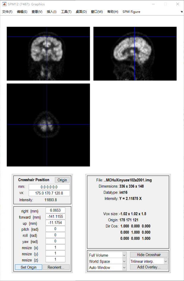 Spm12 入门教程_spm12入门教程-CSDN博客