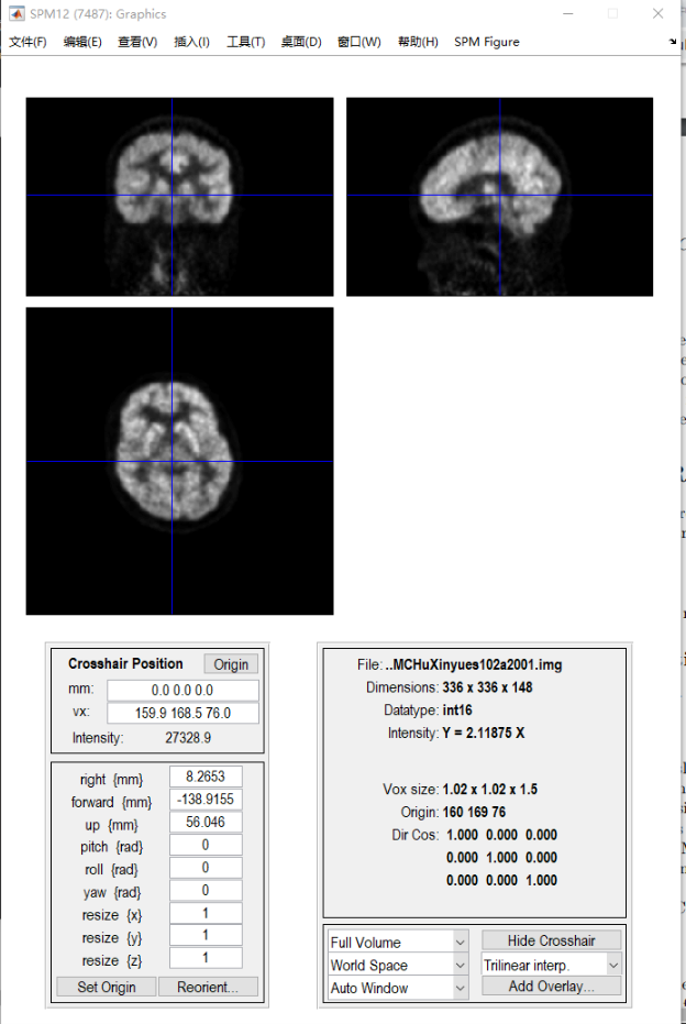Spm12 入门教程_spm12入门教程-CSDN博客