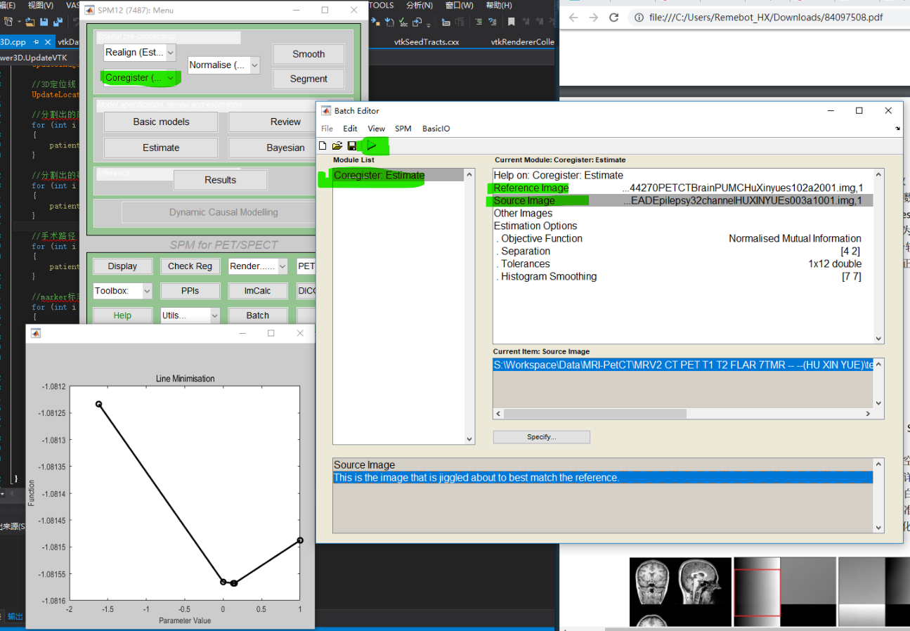 Spm12 入门教程_spm12入门教程-CSDN博客