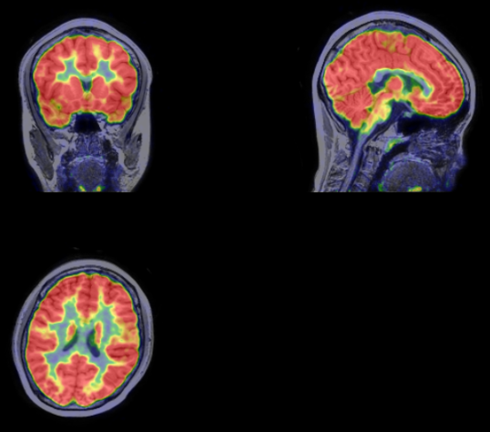 Spm12 入门教程_spm12入门教程-CSDN博客