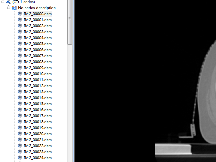 Dicom 文件 转成 JPG 格式（批量处理）_东软dicom 导出-CSDN博客