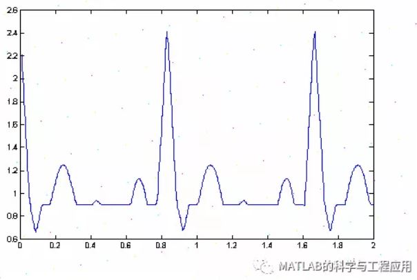 【源码】心电图ECG信号的MATLAB仿真_正常人的心电图仿真模拟-CSDN博客