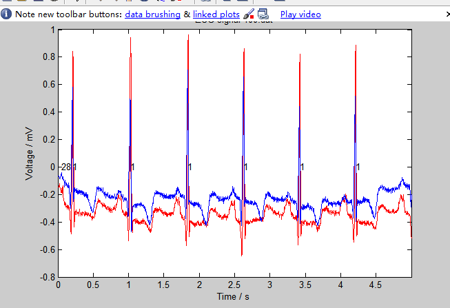【ECG实践篇(1)】MIT-BIH数据库数据解析的方法以及使用rdann获取人工标注注释的方法_physiobank数据库的工具包,wfdb可用来帮助我们分析解读physiobank数据库中 ...