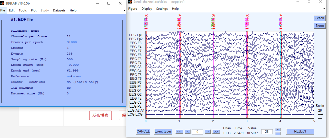 eeglab学习记录（1）-eeglab安装+导入EDF数据_CherylDee的博客-CSDN博客