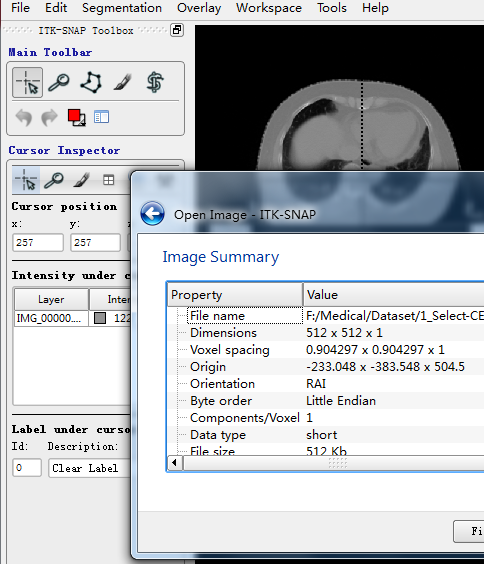 ITK-SNAP 安装和使用_itksnap下载-CSDN博客