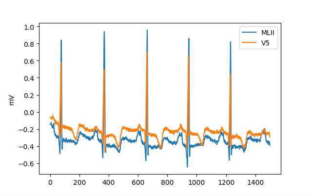 Python中的WFDB库使用_python wfdb-CSDN博客