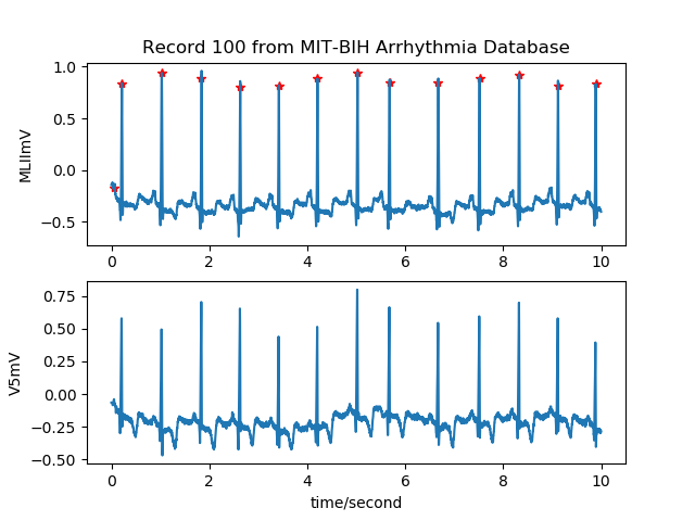 Python中的WFDB库使用_python wfdb-CSDN博客