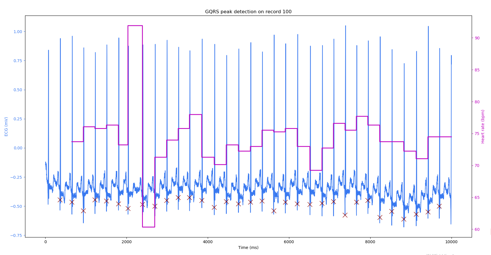 Python中的WFDB库使用_python wfdb-CSDN博客
