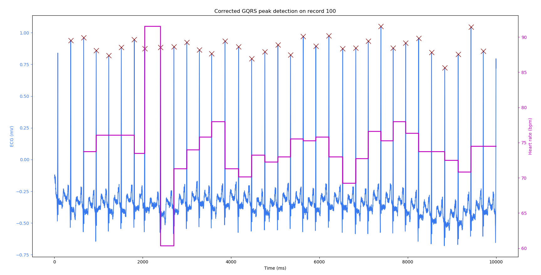 Python中的WFDB库使用_python wfdb-CSDN博客