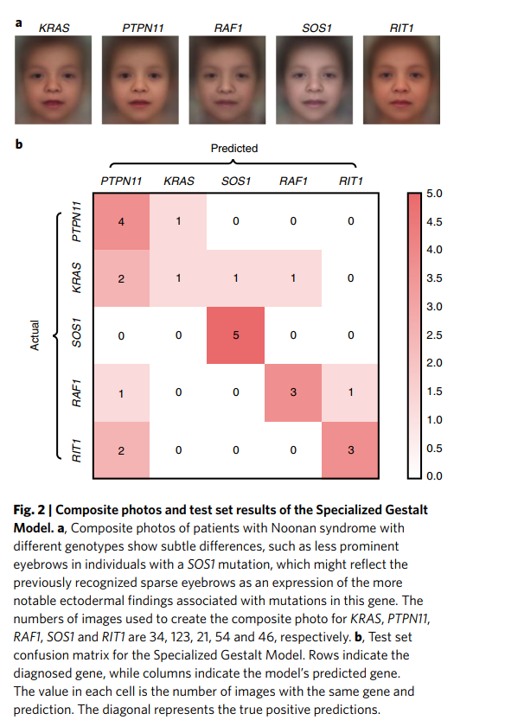 NatureMedicine文章Identifying facial phenotypes genetic disorders ...