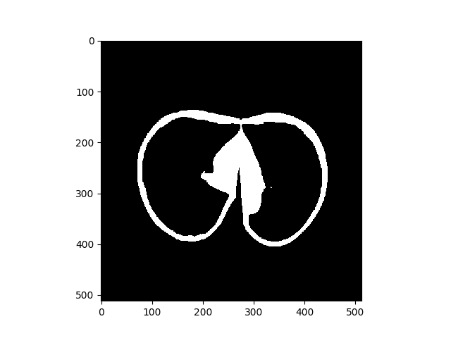 LUNA16_Challange数据预处理4_luna16mask-CSDN博客