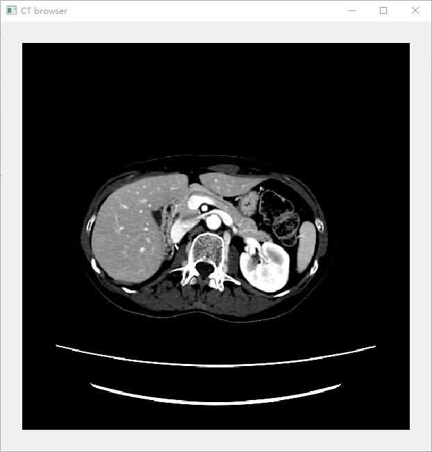 DeepLesion 数据集文件查看工具_deeplesion数据集-CSDN博客