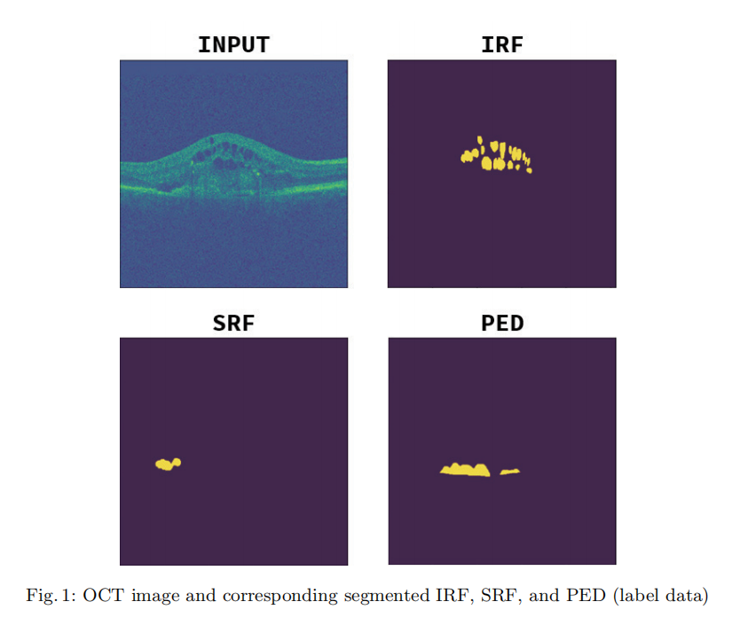 【医疗图像分割】Deep neural networks for the detection and segmentation of the ...