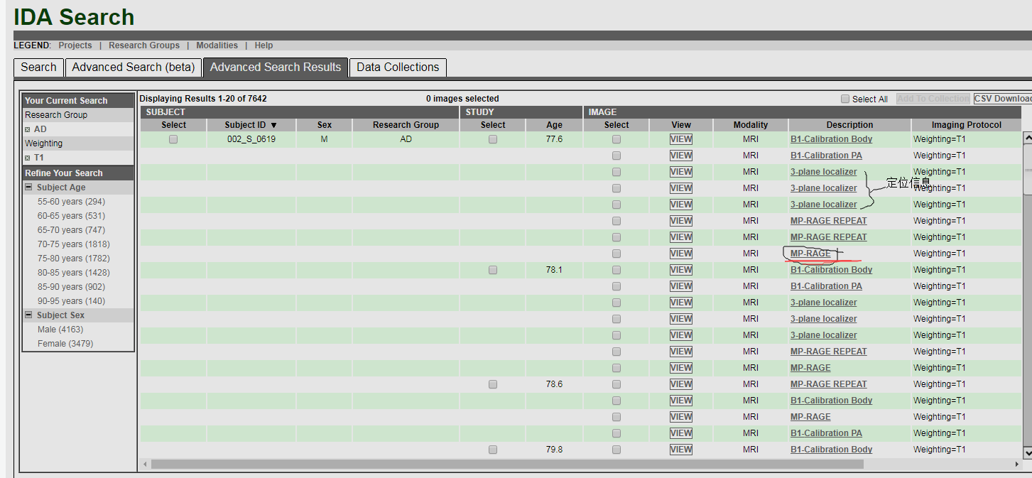 ADNI数据集下载（详细）_adni脑部图像数据集的标签怎么下载-CSDN博客