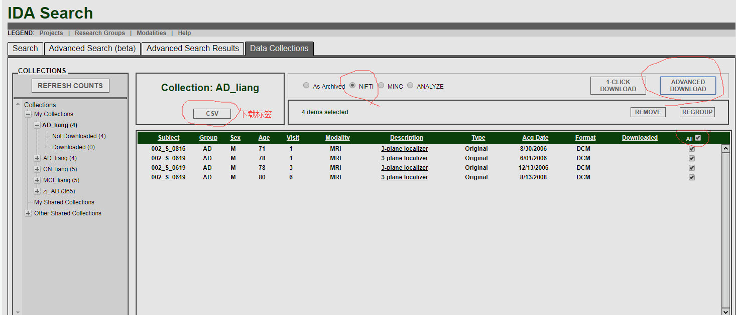 ADNI数据集下载（详细）_adni脑部图像数据集的标签怎么下载-CSDN博客