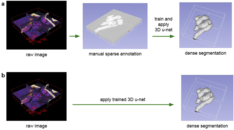 论文关键点分析：3D U-Net: Learning Dense Volumetric Segmentation from Sparse Annotation_基于3du-net的关键点检测 ...