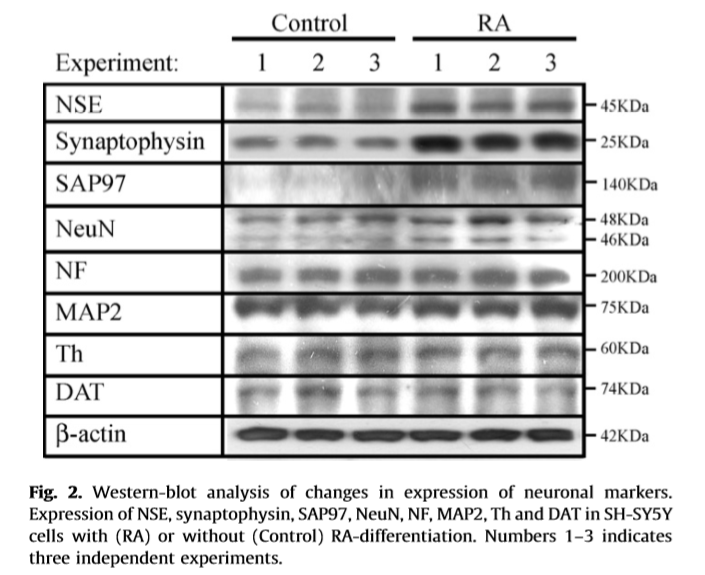 Effects of all-trans-retinoic acid on human SH-SY5Y neuroblastoma as in vitro model in ...