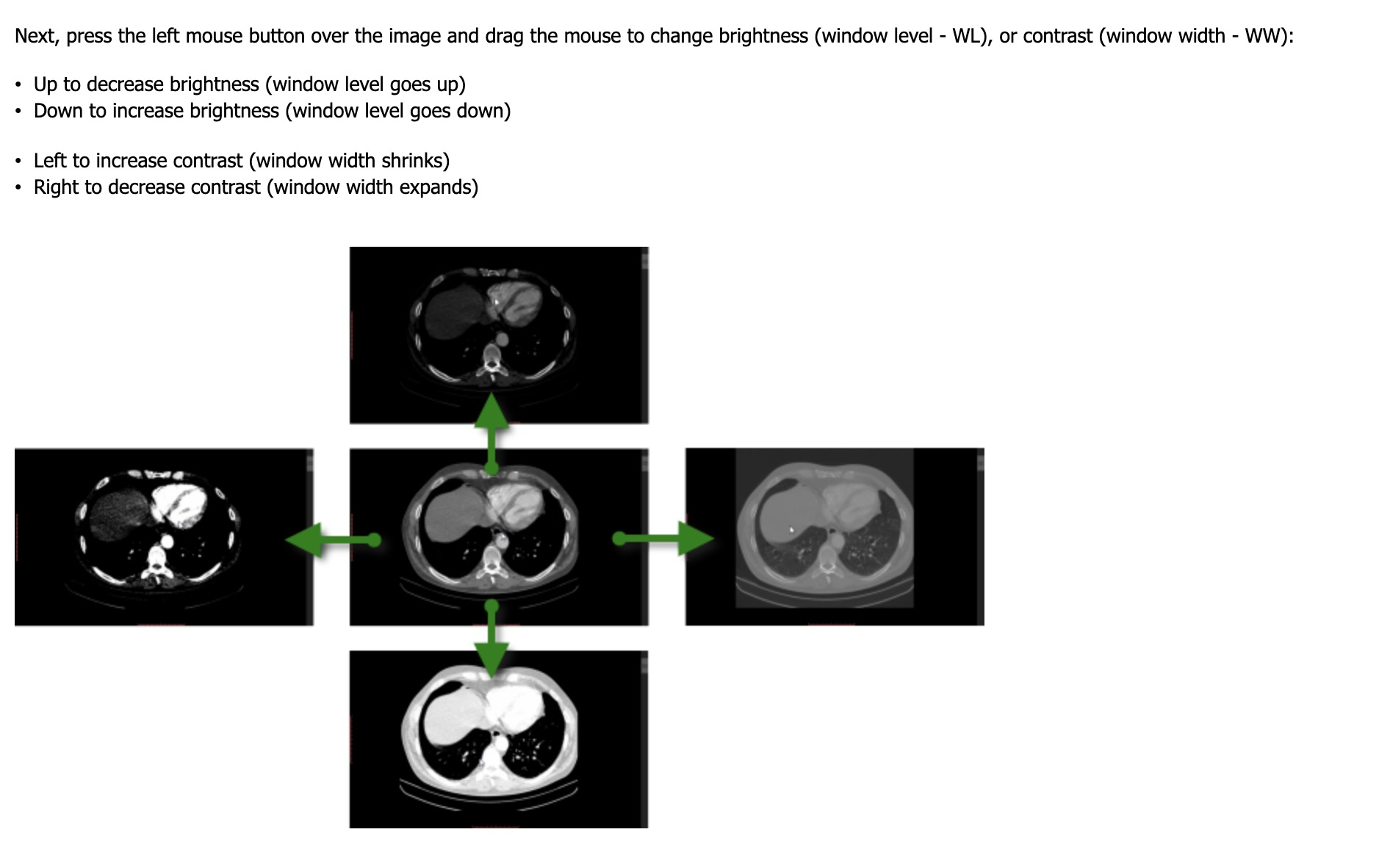 医学图像预处理（三）——windowing(ct对比增强）_windowing方法-CSDN博客