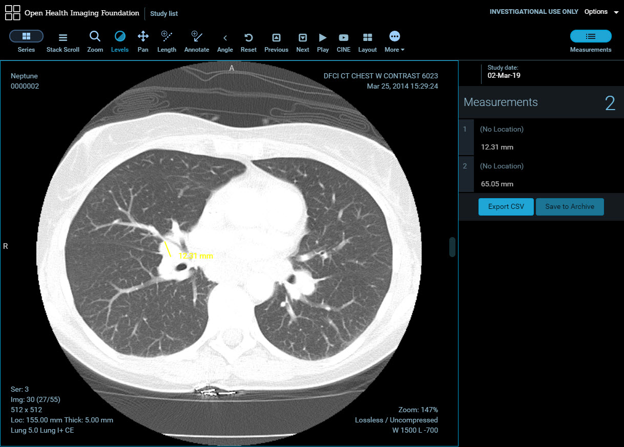 从Cornerstone到OHIF Viewer—JS影像前端开发最佳范例_ohif viewers nii.gz-CSDN博客