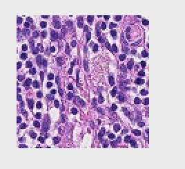 利用CNN神经网络框架(ResNet)进行癌症检测(Pytorch)_cnnframeworkdata-CSDN博客