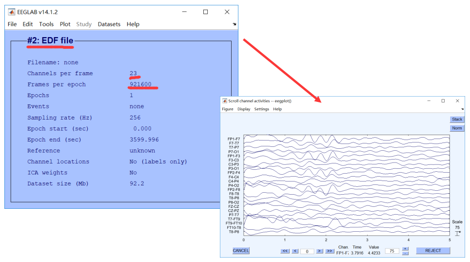 脑电图机器学习笔记(一)：机器学习脑电图.edf格式数据处理_脑电edf文件-CSDN博客