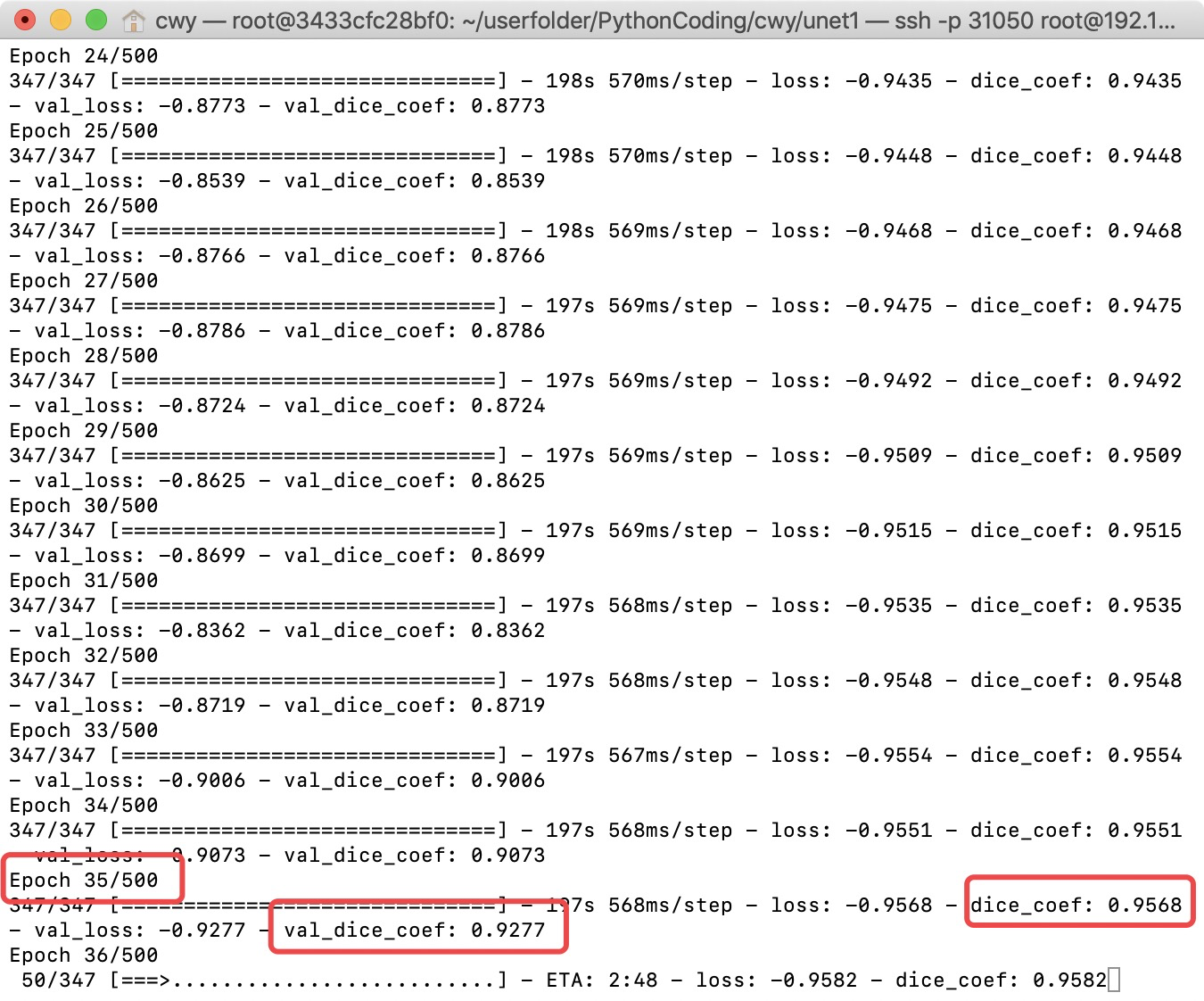 医学图像分割 基于深度学习的肝脏肿瘤分割 实战(一）_numpy-CSDN博客