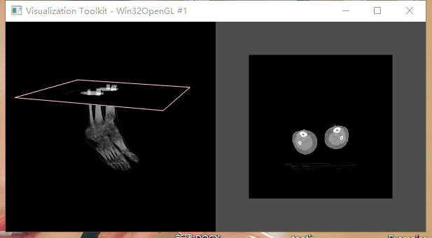 VTKImagePlaneWidget任意平面的提取-CSDN博客