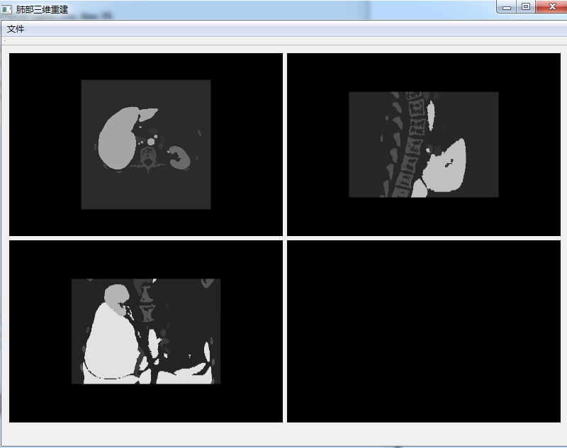 整合QT、VTK、ITK联合开发的简单Demo_使用vtk的开源软件-CSDN博客