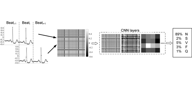 基于深度学习的ECG论文笔记(一)_基于深度学习的心律失常判别英文论文-CSDN博客