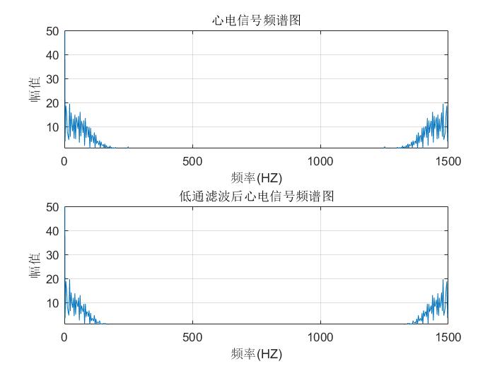基于MATLAB实现ECG心电信号处理_matlab,生产心电图-CSDN博客